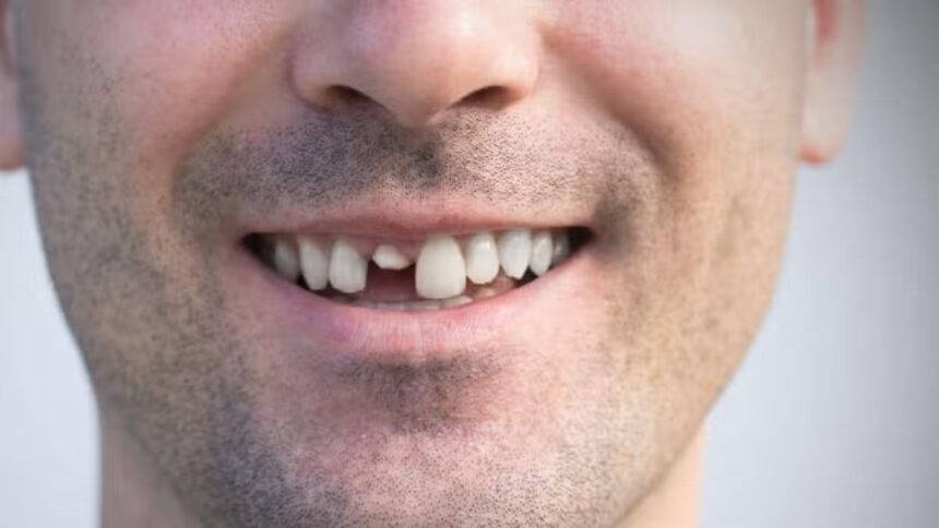 Tooth Regeneration Revolution: Japan’s Bold Leap Forward - Patriot Newswire